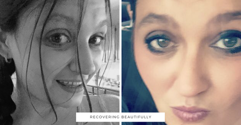 Lindsey's Story - Recovering Beautifully - Juggling the Jenkins