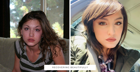 Shannon's Story - Recovering Beautifully - Juggling the Jenkins